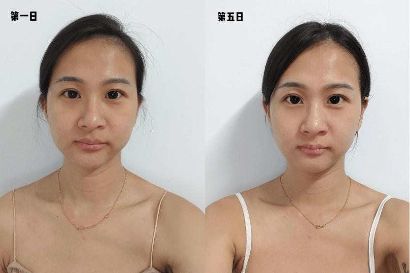 Me*code 讓我輕鬆吃出滿滿美妍力！ - 哈囉我是葉太太 (@couple__ya) | Dcard