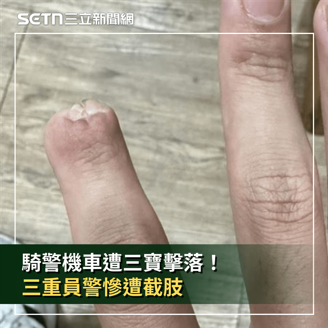上班遇劫！騎警機車遭「鬼切三寶」擊落 三重員警慘遭截肢 - SETN三立新聞網 (@setn54) | Dcard