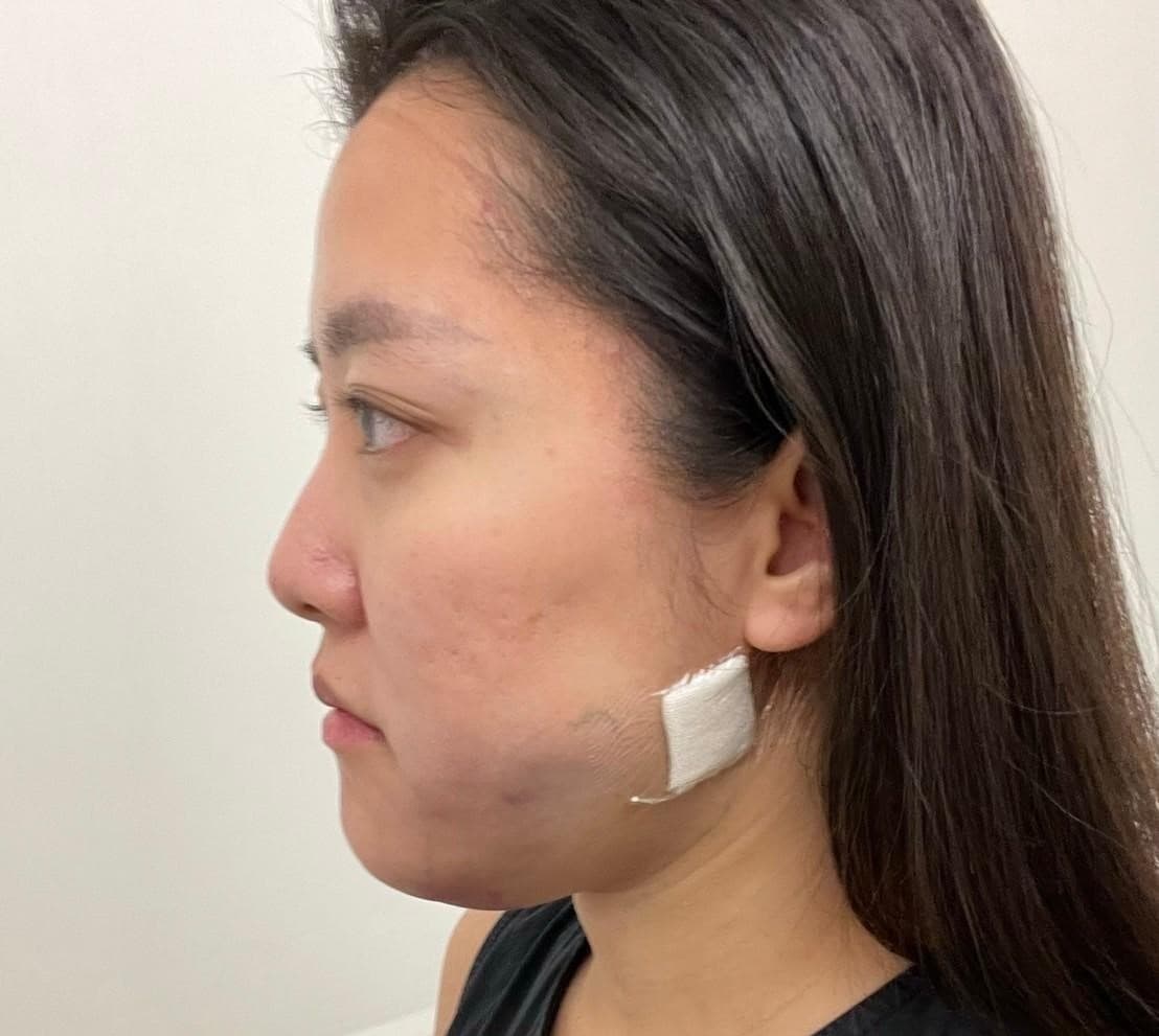 #分享 終於找回我的輪廓線 雙下巴消失全紀錄!! - 狂愛日本的女紙 (@der0311) | Dcard