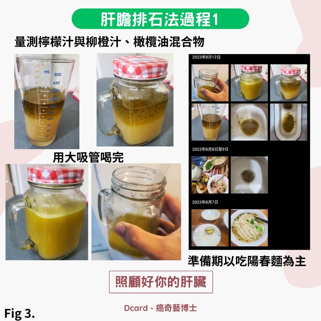 肝膽排石法的3次實際體驗過程與心得(文長，有屎照) - 癌奇藝博士 (@gd810424) | Dcard