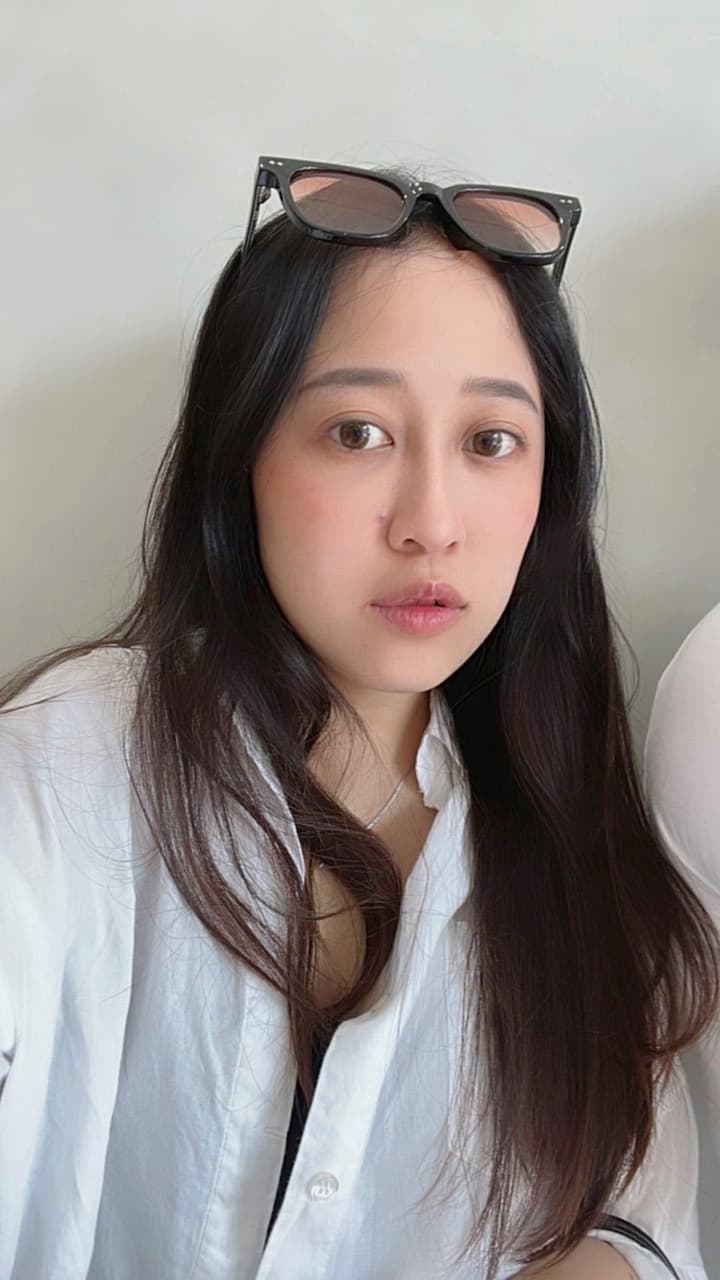 #分享 ～ 做眼袋手術的成果照 - 醫美板 | Dcard