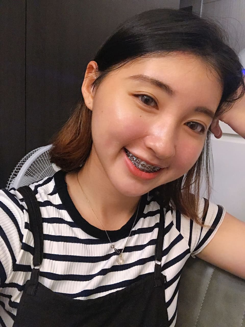 #文長有圖 中山醫正顎手術分享（下） - B103 留言 | Dcard