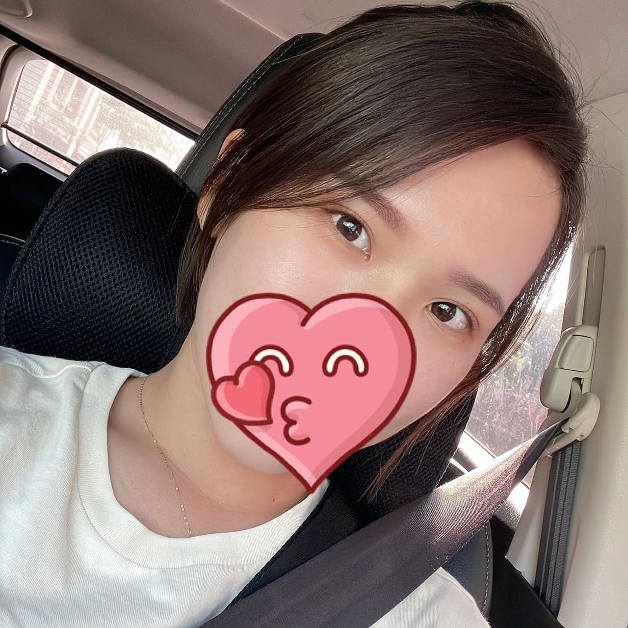 #分享 縫雙眼皮術後15天 - B92 留言 | Dcard