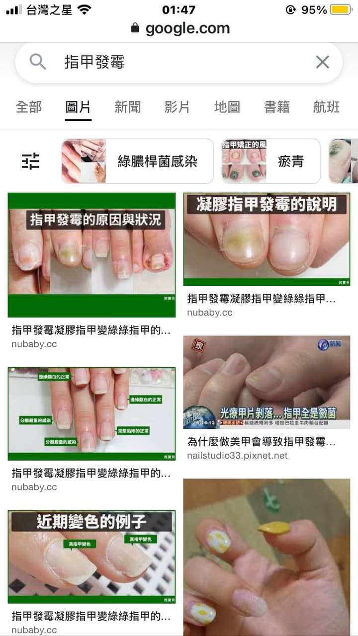 問題 甲溝藍藍的 是發霉嗎😱 美甲板 Dcard
