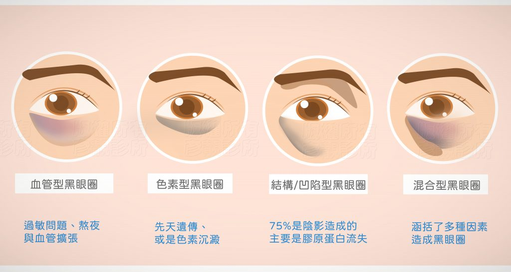 請益 超重黑眼圈如何改善 美妝板 Dcard