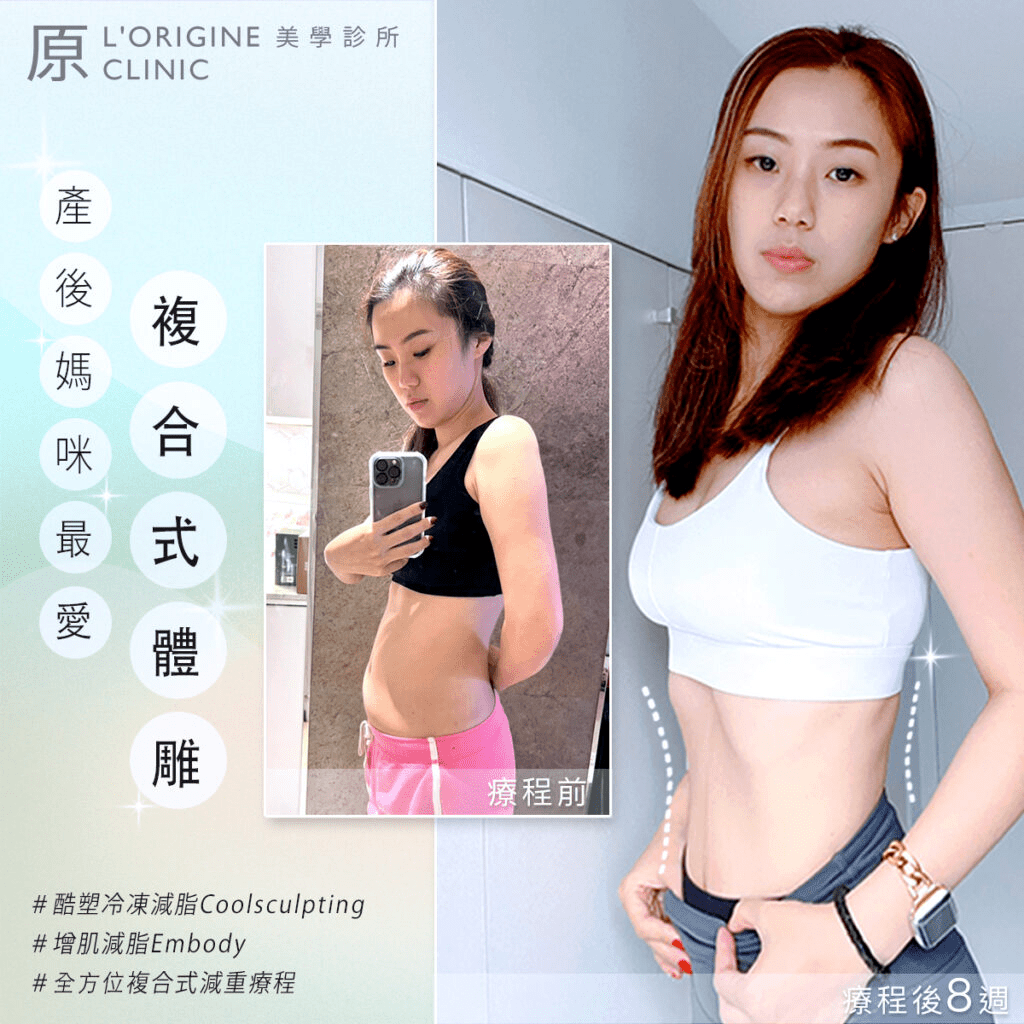 #知識 多囊性卵巢症候群 妳知多少？ - 原美學診所 (@lorigine) | Dcard