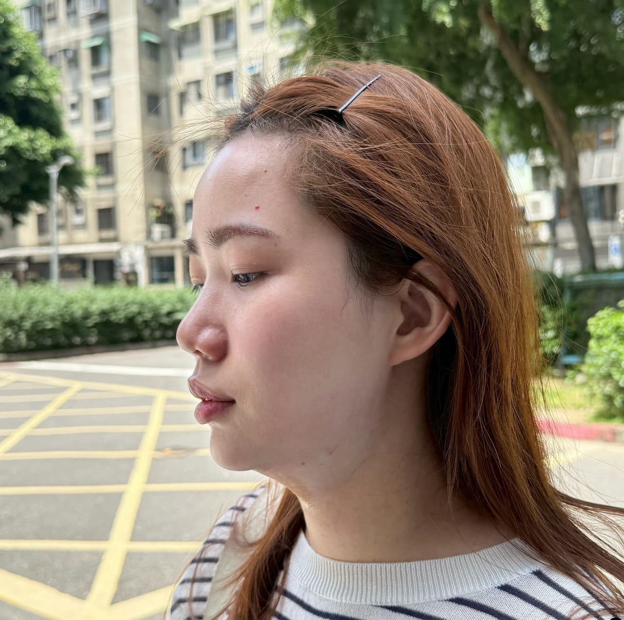 原來雙下巴是可以這麼簡單可以解決的！ - 菜鳥日誌 (@yy_mylife) | Dcard