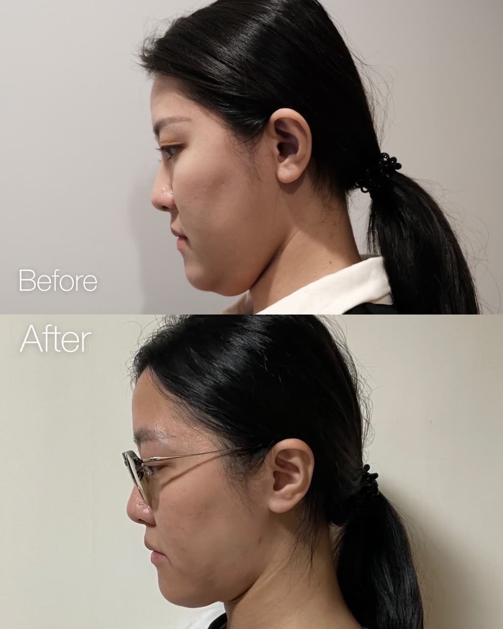 #分享 終於找回我的輪廓線 雙下巴消失全紀錄!! - 狂愛日本的女紙 (@der0311) | Dcard