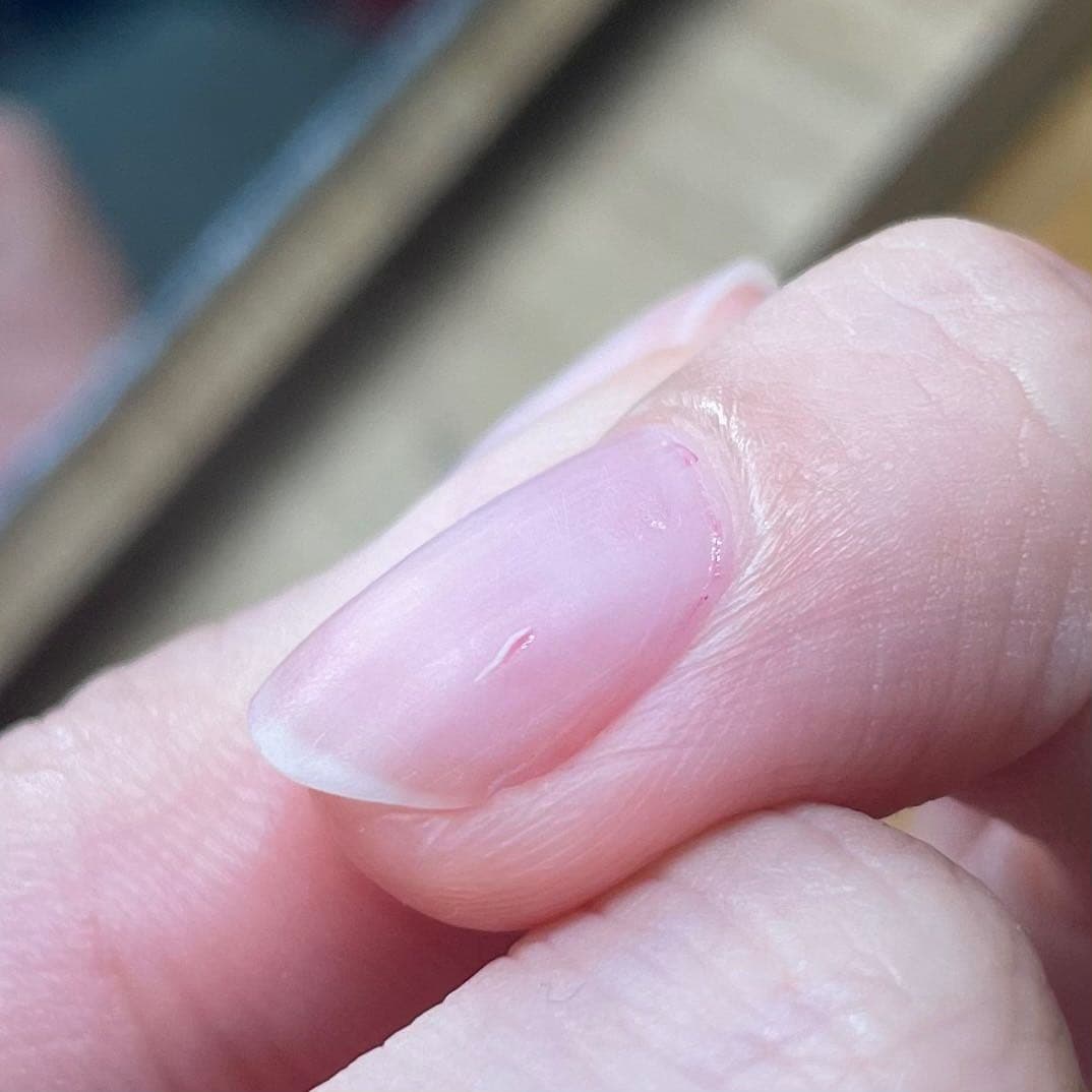 問題 有人的指甲被卸成這樣過嗎? 美甲板 Dcard