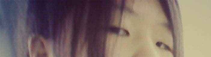 #分享 割雙眼皮+提眼肌 滿三個月詳細分享 超級滿意😍 - 醫美板 | Dcard