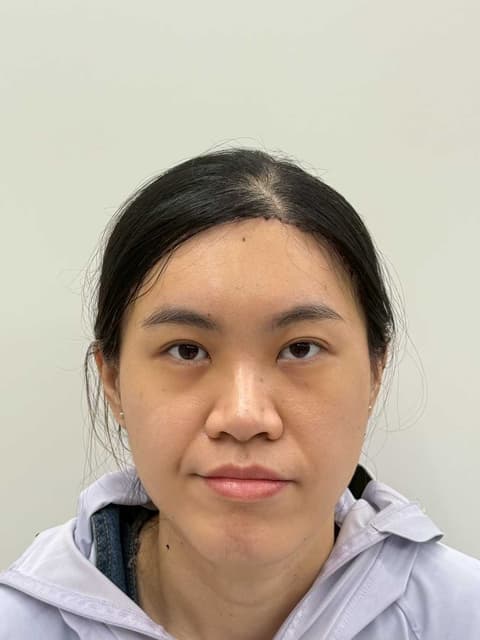 #分享 想要雙眼皮卻變成去拉皮XD - B26 留言 | Dcard