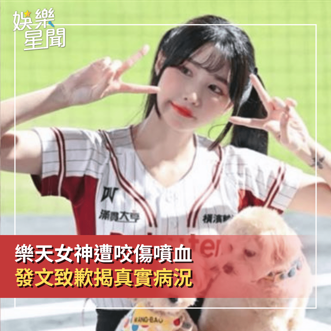 樂天女神遭咬傷流整臉血 險傷及眼球！發文致歉揭真實病況 - SETN三立新聞網 (@setn54) | Dcard