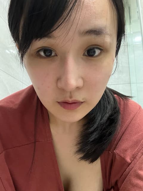 #詢問 #大家打完鳳凰當下會紅嗎？ - 醫美板 | Dcard