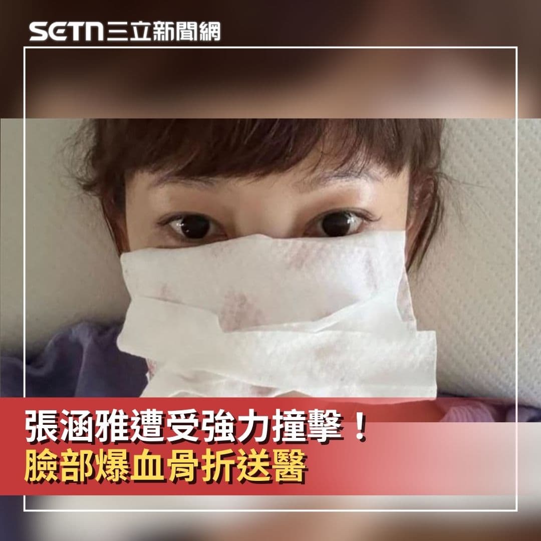 張涵雅遭受強力撞擊！臉部爆血骨折送醫 曬X光照片明顯斷裂 - SETN三立新聞網 (@setn54) | Dcard