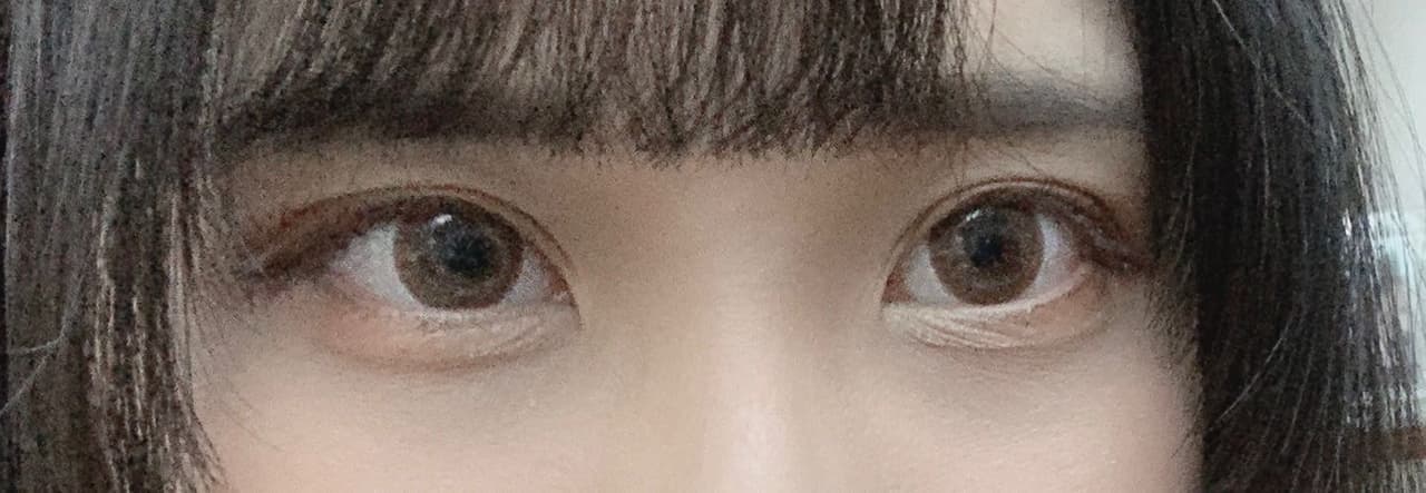 #分享#釘書針雙眼皮 - B80 留言 | Dcard