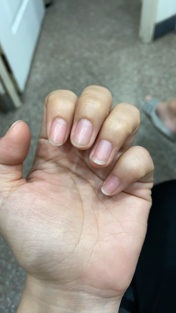 問題 卸甲後甲床分離 美甲板 Dcard