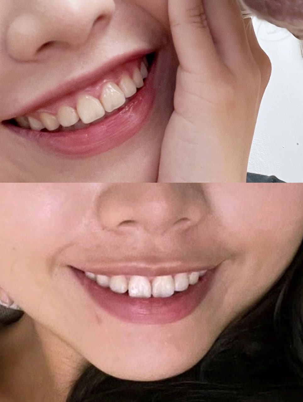 #分享 四款開架美白牙膏心得🦷Crest/好萊/Ora2/高露潔 - 美妝板 | Dcard