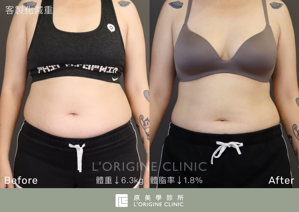 #知識 少吃也不會瘦的原因 - 原美學診所 (@lorigine) | Dcard