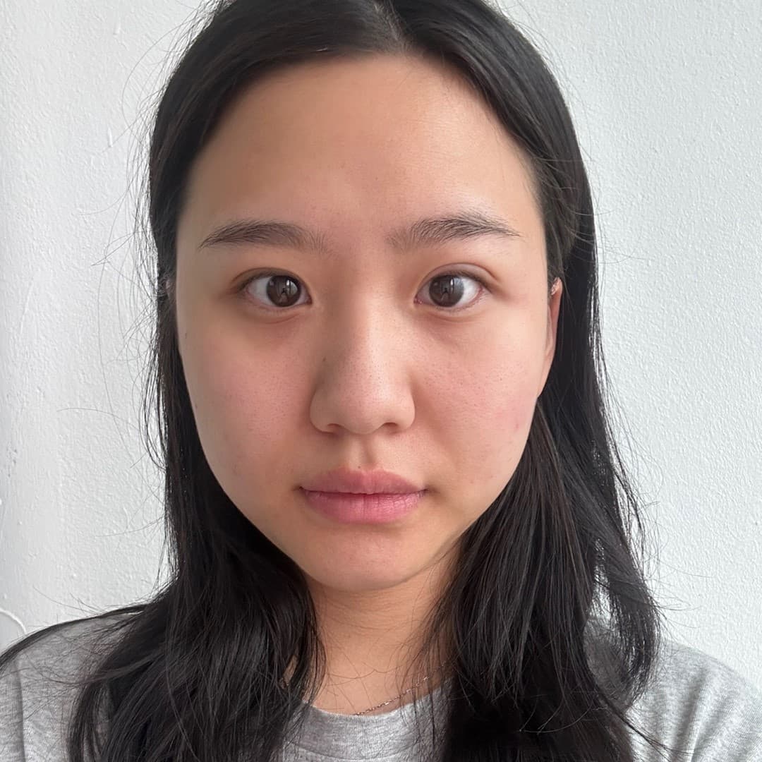 #分享 眼鼻手術一起做是什麼體驗？ - B41 留言 | Dcard