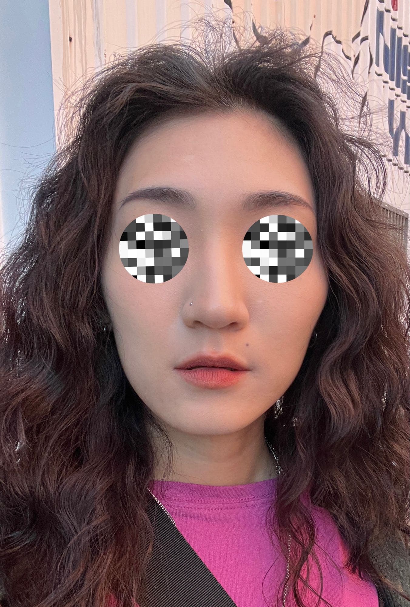 #詢問 這樣的臉型建議做什麼項目 - 醫美板 | Dcard