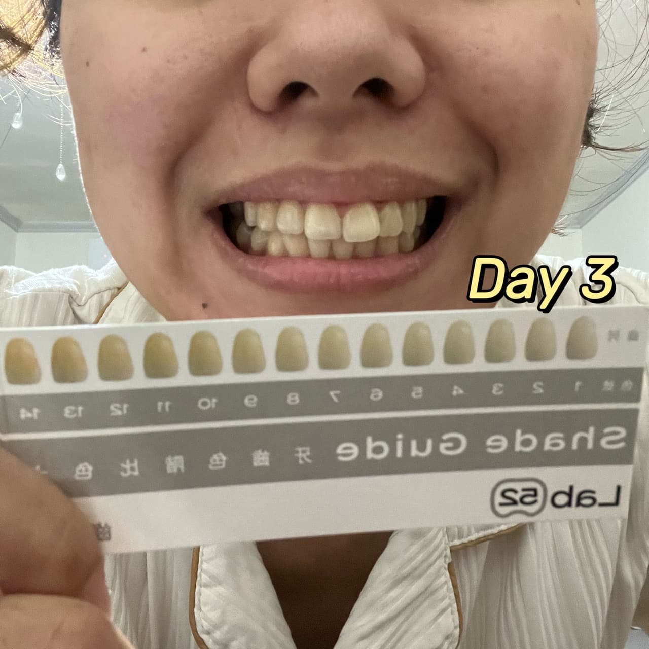 Lab52齒妍堂美齒面膜7天實測心得 (圖多) - 美妝板 | Dcard