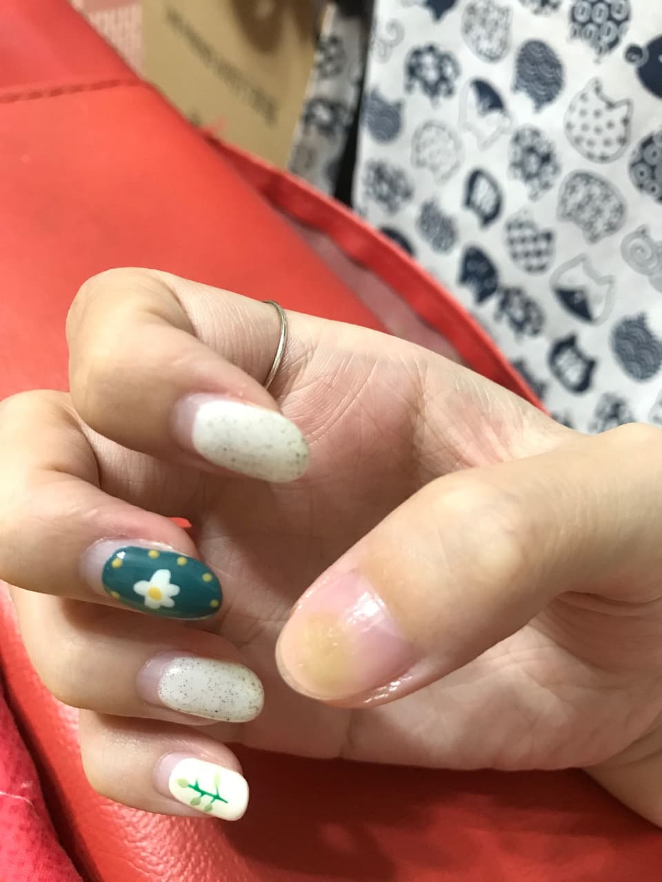問 指甲發霉 綠膿桿菌 美甲板 Dcard