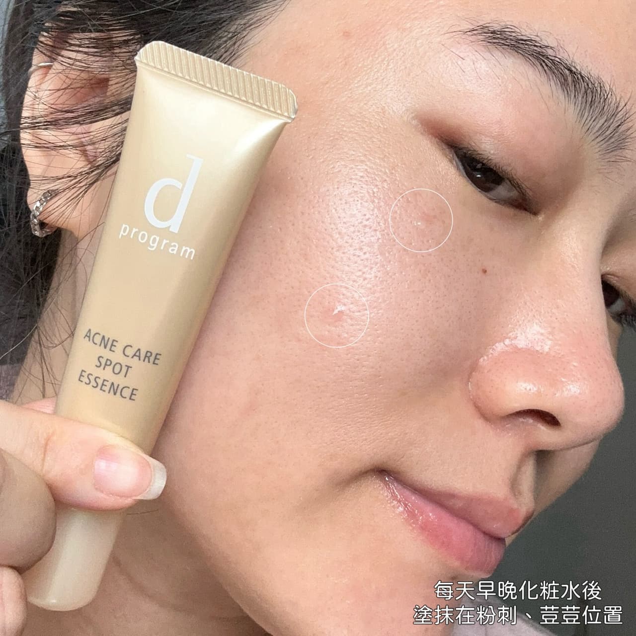 皮膚又在發瘋了嗎？你需要#d program 敏感話題💛 - 摸你卡撐 (@vivi47) | Dcard