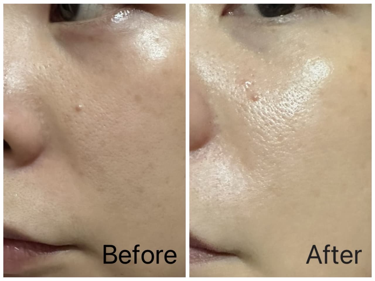 眼下乾紋say goodbye 👋🏻👀 - 贊助板 | Dcard