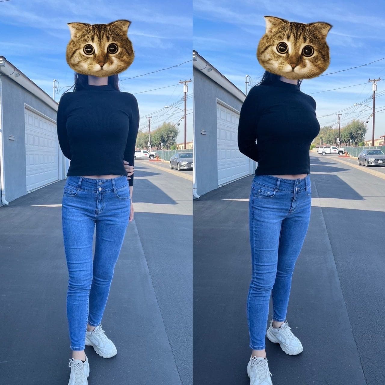 #分享 超有感的大小腿抽脂&PRP補胸 part 1 - 醫美板 | Dcard