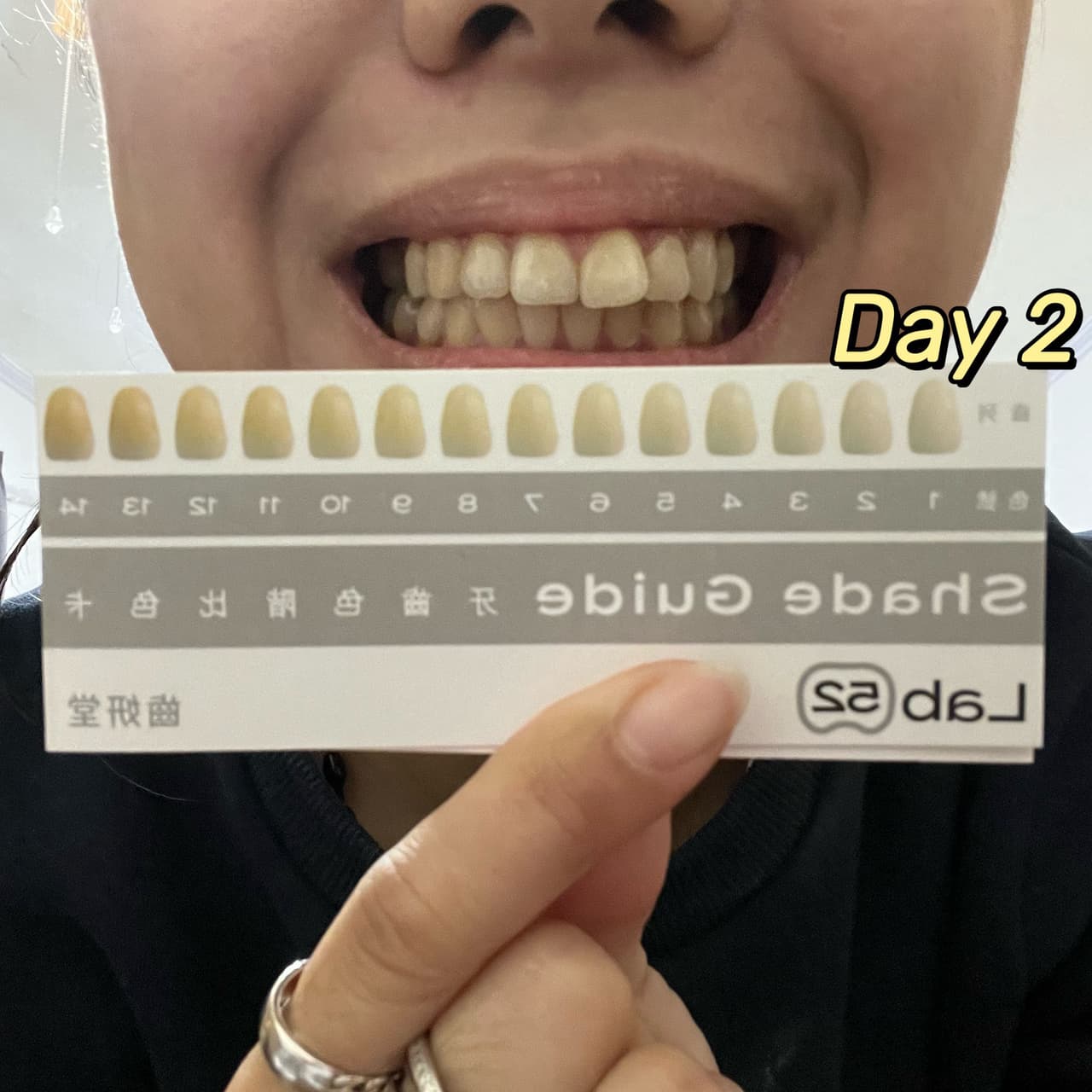 Lab52齒妍堂美齒面膜7天實測心得 (圖多) - 美妝板 | Dcard