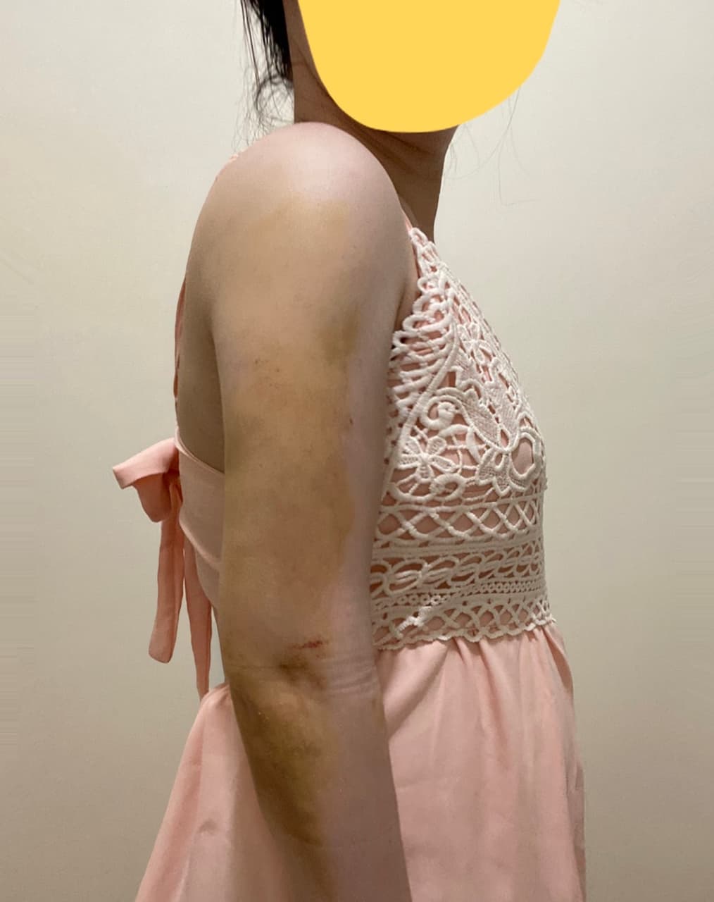 #分享 想在婚禮上穿好看的禮服當個漂亮的新娘子！ - 晶美整形 (@skin1000) | Dcard