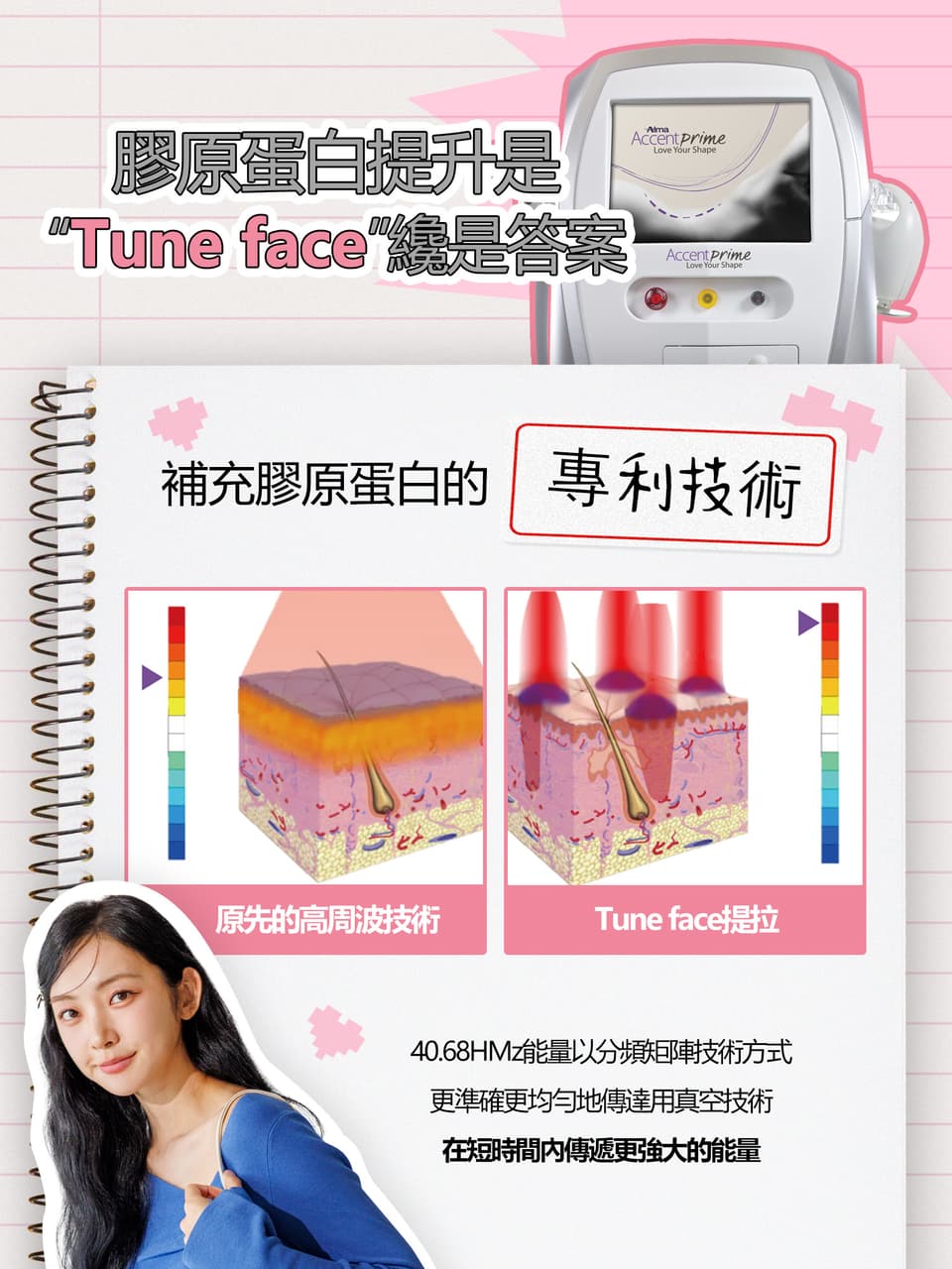 怕痛也能做的拉提？Tune Face 有什麼不一樣？ - jfeelclinic桔藝菲皮膚科 (@jfeelclinic_tw) | Dcard