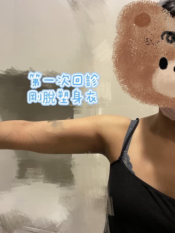 分享想要的纖細手臂 - 晶美整形 (@skin1000) | Dcard