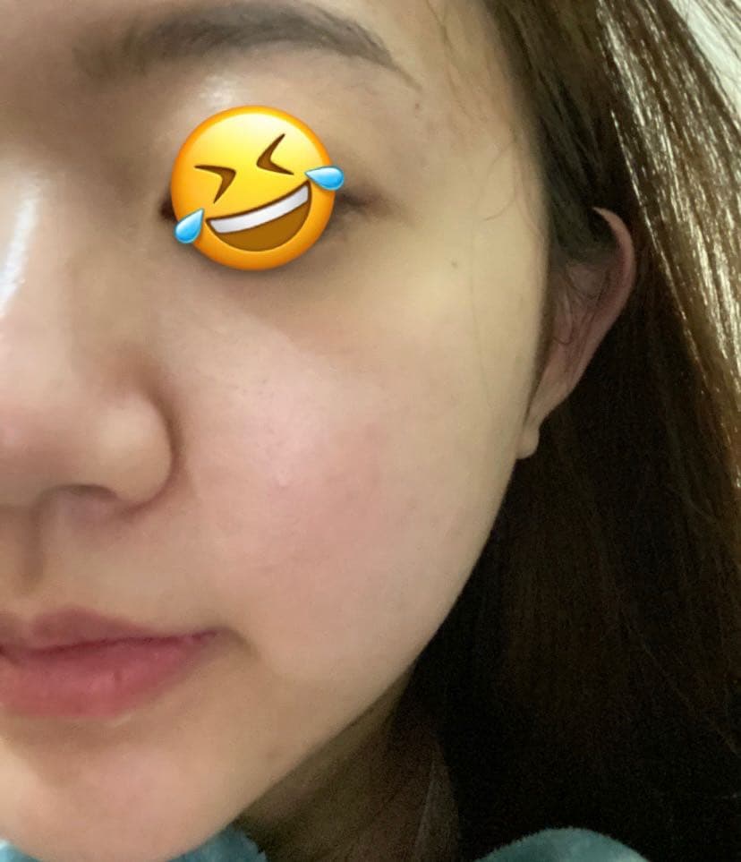 台北皮秒超便宜！！ - 美妝板 | Dcard