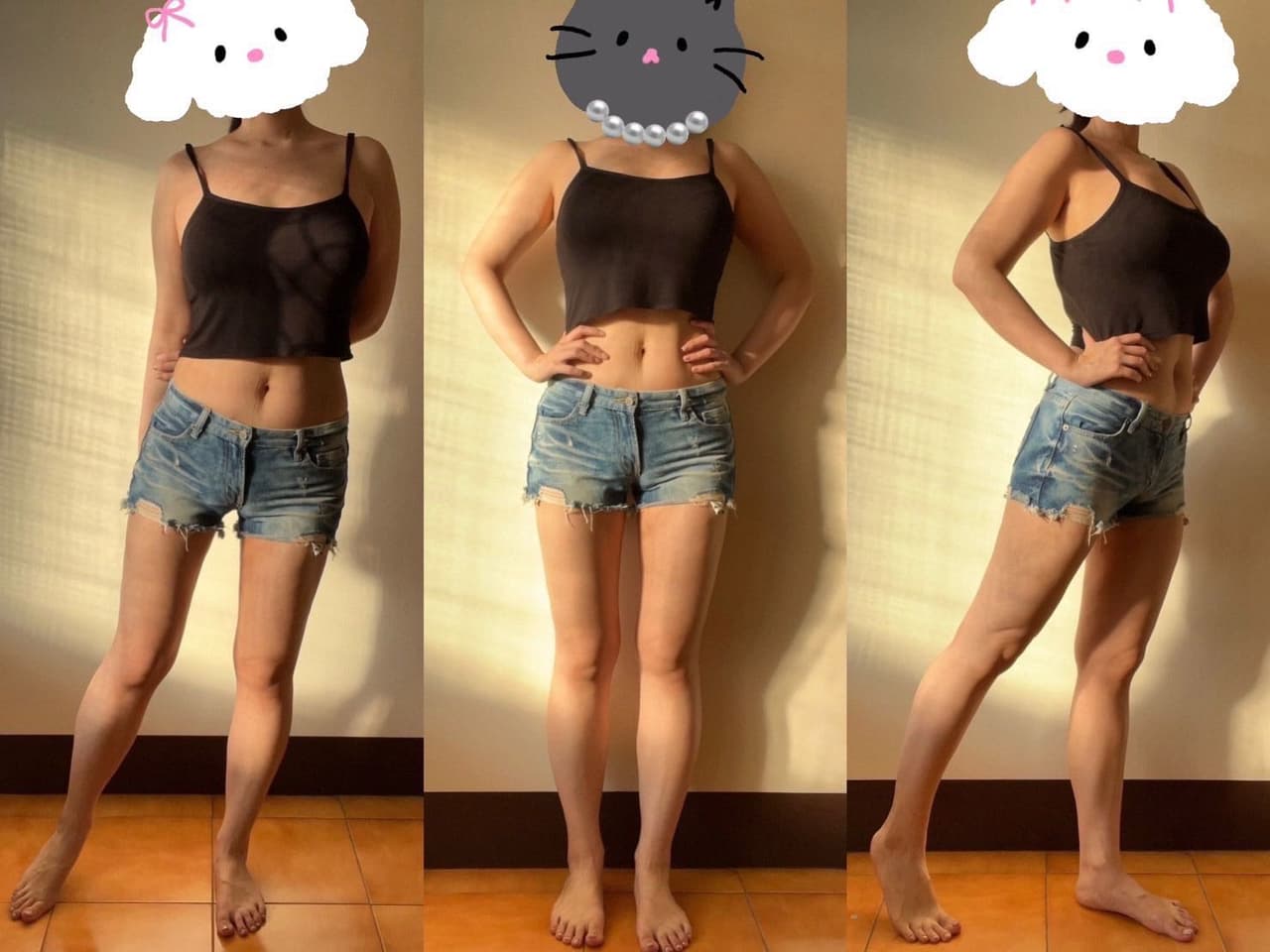 #分享 大小腿抽脂&PRP補胸Part 2 - 醫美板 | Dcard