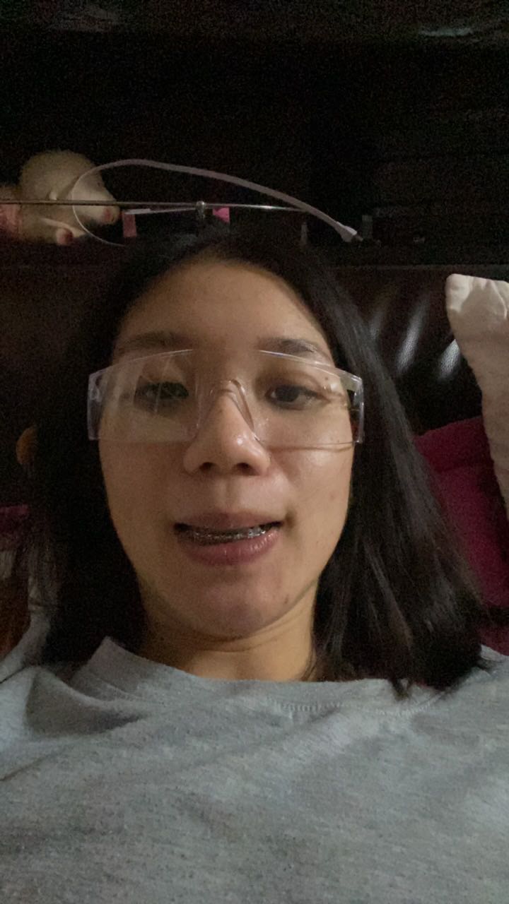 #分享 #分享雷射眼睛 - 醫美板 | Dcard