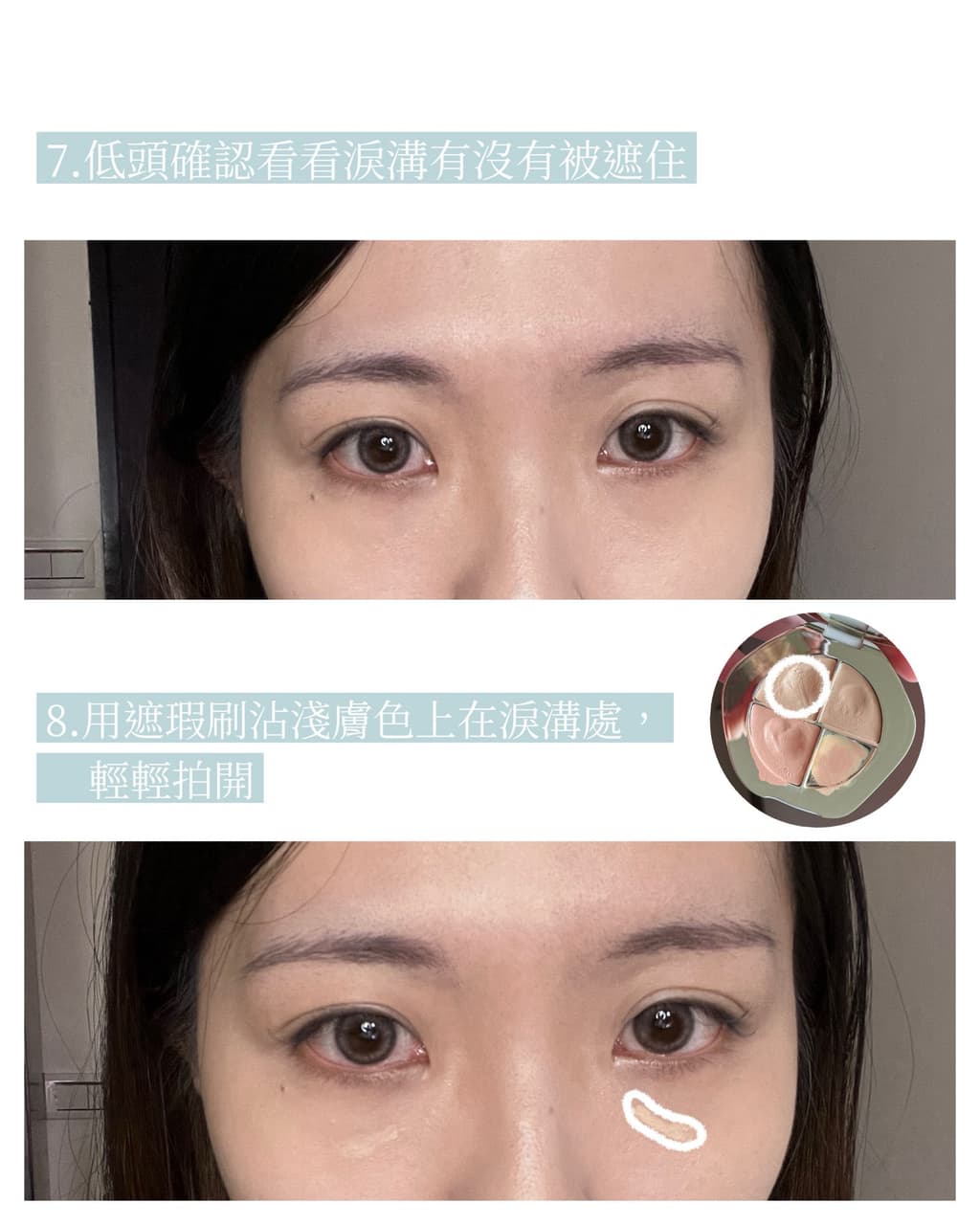 終於～！從黑眼圈淚溝系畢業😭 - 璇 (@cathycrazyyy) | Dcard