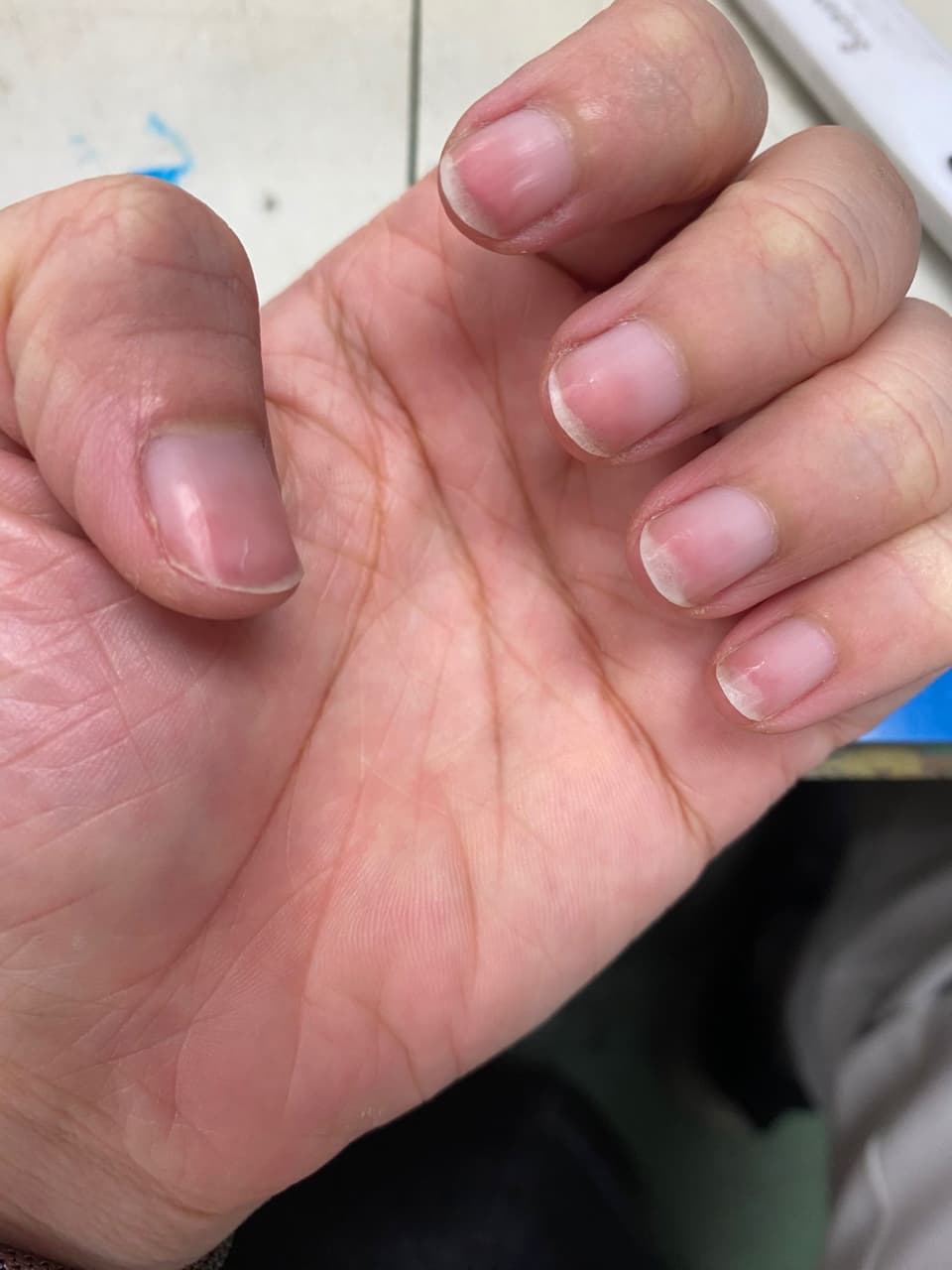 問題 問題 美甲卸甲後甲床內縮 美甲板 Dcard