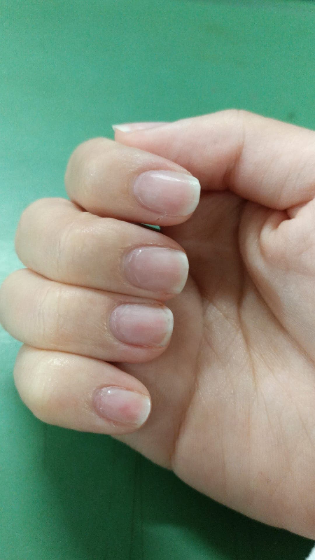 黑特 卸甲沒卸乾淨又受傷 美甲板 Dcard