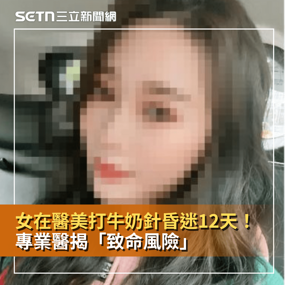 女在醫美打「牛奶針」昏迷12天！專業醫揭「致命風險」 - SETN三立新聞網 (@setn54) | Dcard