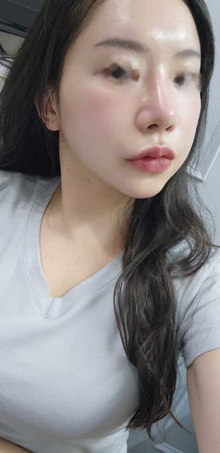 花了300萬整形的人生 - 女孩板 | Dcard