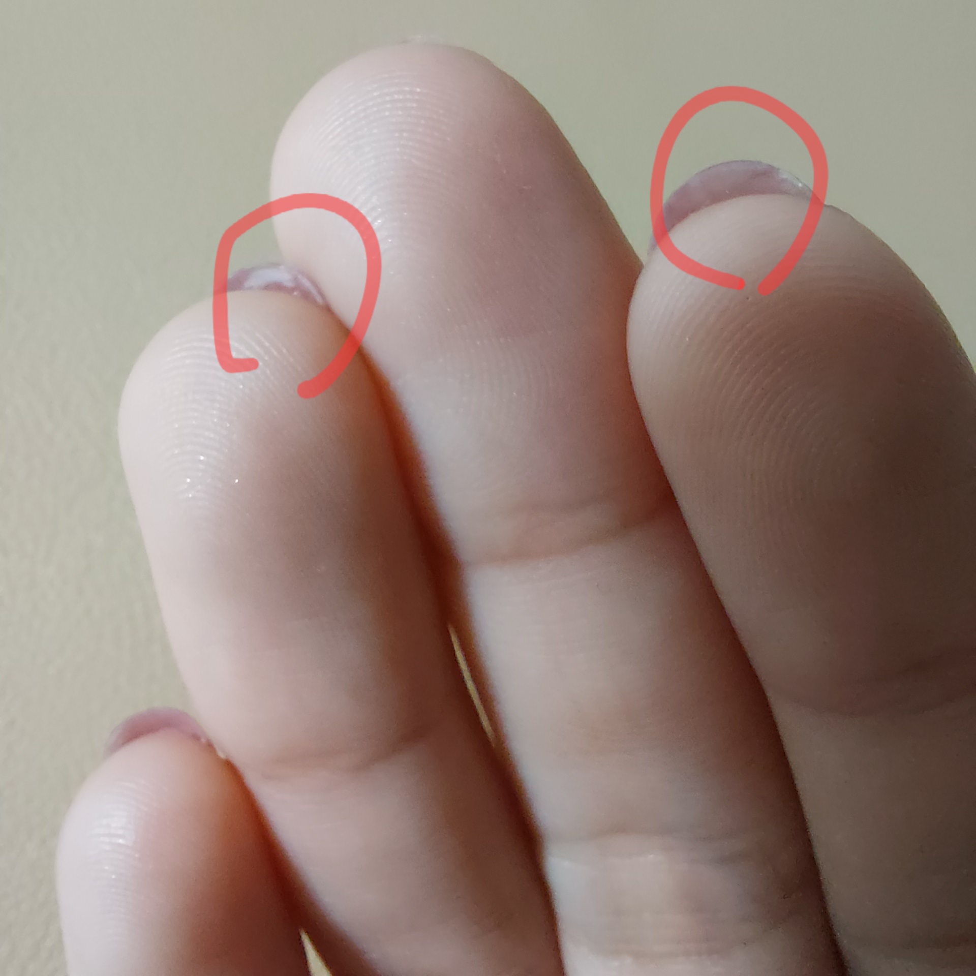 問題 這樣算指甲發霉嗎? 美甲板 Dcard