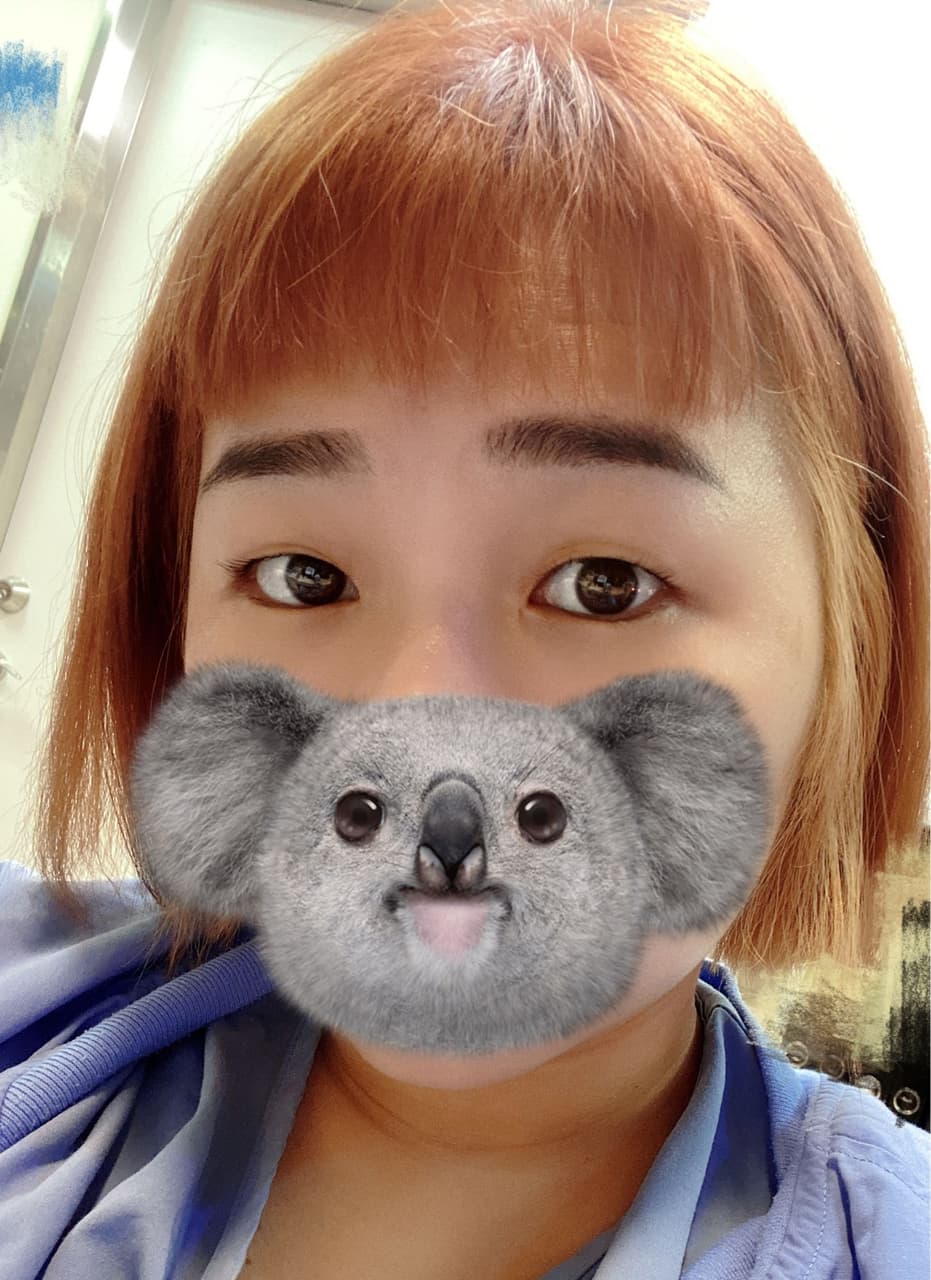 #分享 割雙眼皮滿一年🥳終於換我分享啦～ - 醫美板 | Dcard