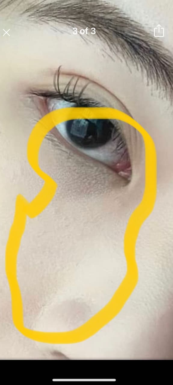 #試色 heme無瑕持久遮瑕棒比預期中厲害 - B24 留言 | Dcard