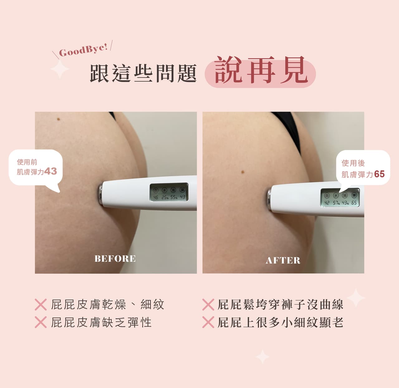 Peachup | u glow藍銅胜肽瞬效緊緻翹臀膜 - 美妝板 | Dcard