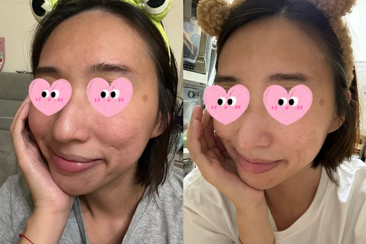 #分享 媲美專櫃的保濕精華！Bello. U鑽石精華乾肌必備 - 美妝板 | Dcard