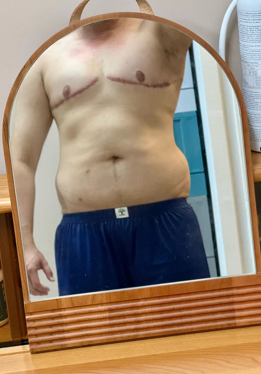 勇敢的說 我是FTM 小小分享 - 跨性別板 | Dcard