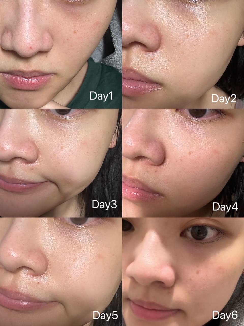 💜理膚寶水 MELA B3淡斑淨亮精華~小紫管實測6天看看效果如何💜 - 咖苦老師☕️ (@kakusmakeup) | Dcard