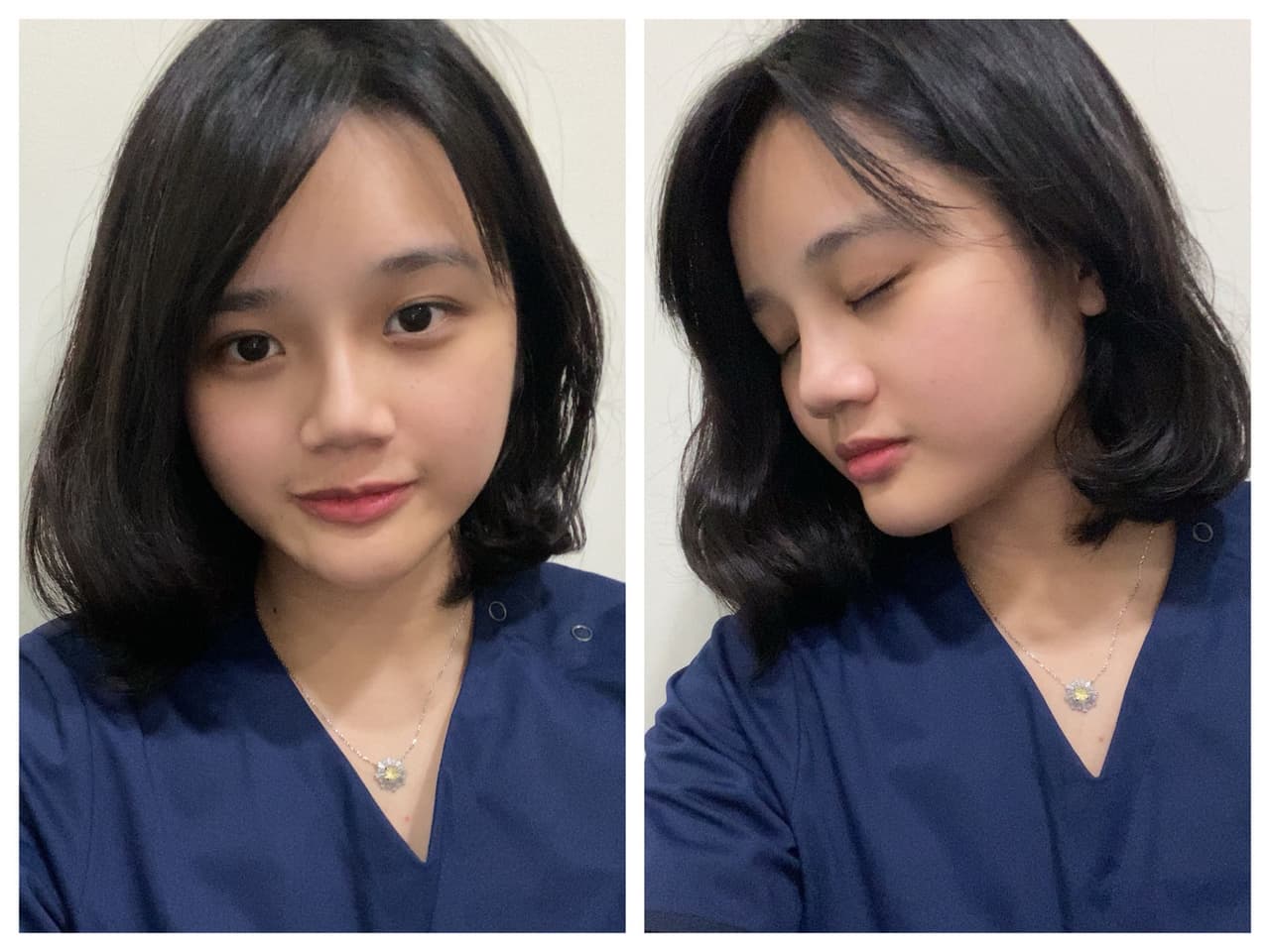 #分享 台北鼻雕初體驗👃（有圖） - 醫美板 | Dcard