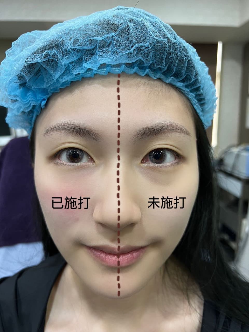 告別黑眼圈 美妝板 Dcard